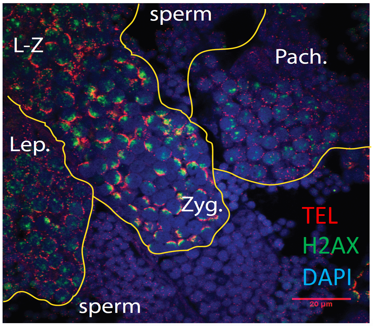 Our Research – Burgess Lab